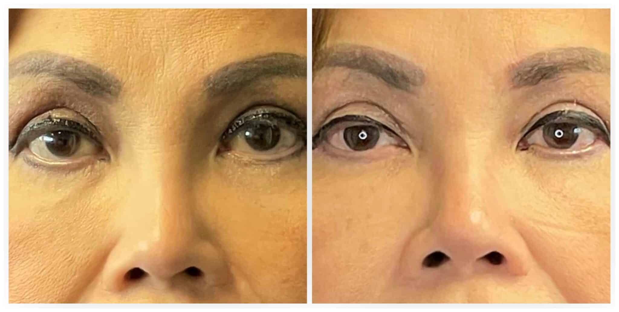 Plastic Surgeon In Edina Dr Camp Echelon Surgical Specialists 7647